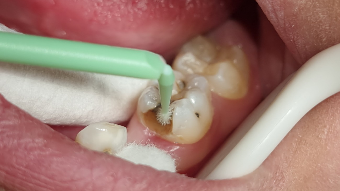 Dental and Medical Problems